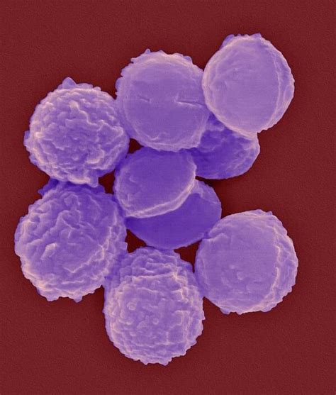 Micrococcus Luteus Poster By Science Photo Library Science Photo Gallery