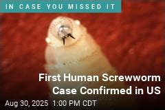 First Human Screwworm Case Confirmed In Us