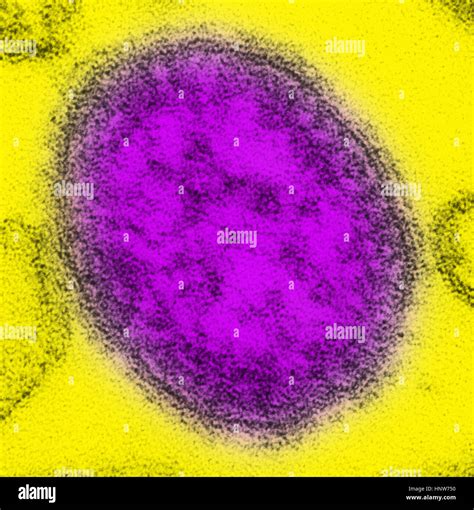 Transmission Electron Micrograph Of A Single Virus Particle Or Virion