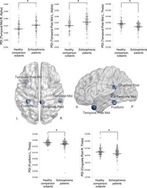 Abnormal Phase Discontinuity Of Alpha And Theta Frequency Oscillations In Schizophrenia Pmc