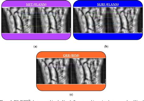 Figure 6 From Wrist Vascular Biometric Recognition Using A Portable