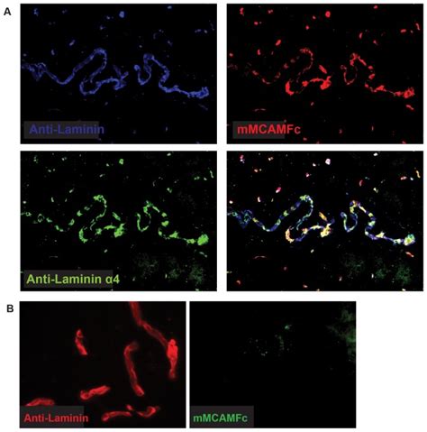 A Staining Of Healthy Mouse Choroid Plexus With Anti Laminin Download Scientific Diagram