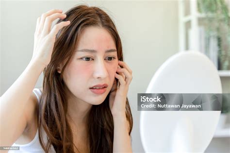 젊은 여성 아시아 얼굴이 걱정됩니다 피부과와 화장품의 스테로이드에 알레르기가 있습니다 민감한 피부 햇볕에 탄 붉은 얼굴 여드름 화학 물질에 알레르기 얼굴에 발진 피부