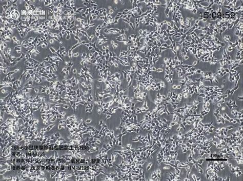 266 6小鼠胰腺腺泡癌细胞培养 知乎