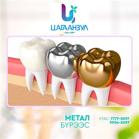 24 цаг ЦАГААНЗУЛ шүдний эмнэлэг Ulaanbaatar