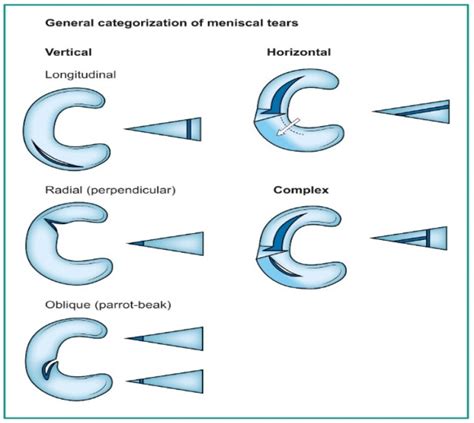A Comprehensive Evaluation Of Deep Learning Models On Knee Mris For The