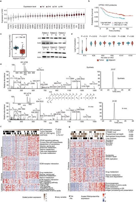 Nat Metab：我国科学家首次通过乳酸化组分析揭示了肝细胞癌的代谢适应新机制 癌症研究专区 生物谷