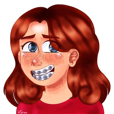 Braces By Ljracho On Deviantart