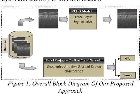 Figure 1 From Layer Segmentation And Detection Of Ga And Drusen From Sd