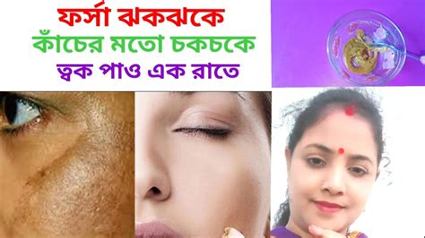 ফর্সা উজ্জ্বল চকচকে ত্বক পেতে রাতে এই উপায়টি করো ত্বক হবে দুধের মত