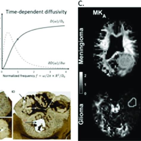 Dedicated Modeling For Tumor Microstructure A Electron Microscopy