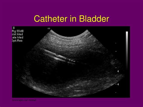 Ppt Ultrasonography Powerpoint Presentation Free Download Id623027