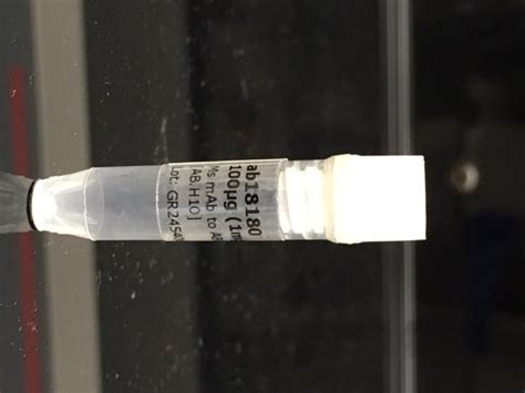 Time Course Effect Of Chemoattractant On Abca1 Expression Biocompare