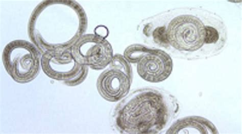About Trichinellosis Trichinellosis Trichinosis Cdc