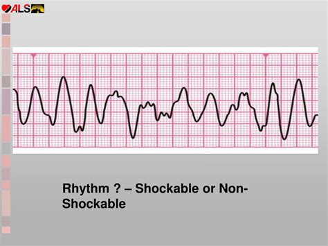 PPT ALS PowerPoint Presentation Free Download ID