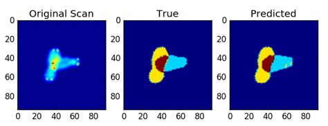 Segmenting Overlapping Chromosomes Using Deep Learning · Iota