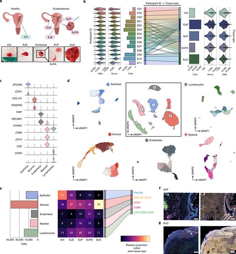 ScRNA Seq From Ctrl And Endometriosis Samples A Schematic Top And Download Scientific