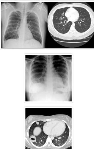msra part 13 msk and rheum flashcards quizlet