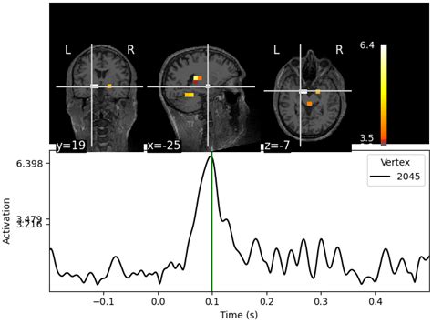 Compute Mne Inverse Solution On Evoked Data With A Mixed Source Space — Mne 161 Documentation