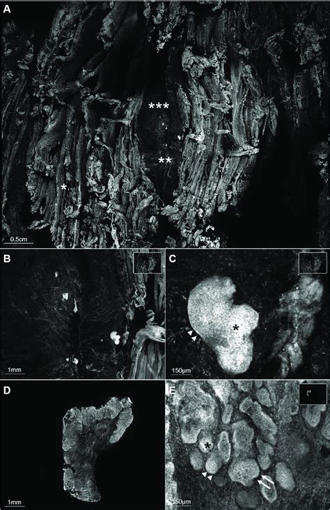 A Illustrative Field Of View Obtained Using Ex Vivo Confocal