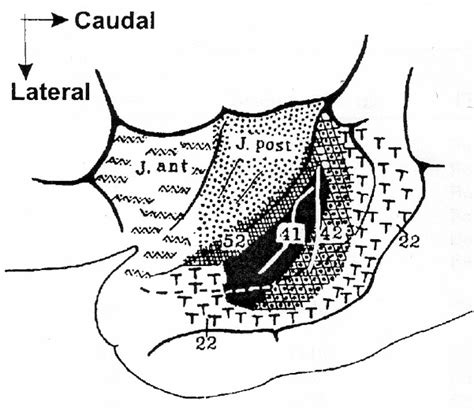 A View Of The Human Supratemporal Plane Brodmann 1909 The Secondary Download Scientific