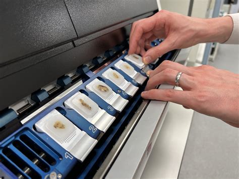 Generation Of Tissue Microarray Tma Commercial Services At