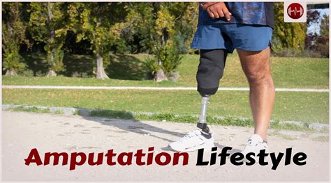 Embracing Life After Amputation A New Beginning Aestheticbeats