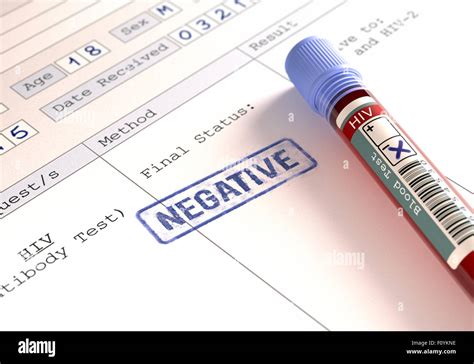 175 Causes Of False Negative Hiv Test False Positive