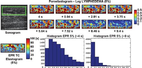 Sonogram Corresponding Poroelastogram Epr Tc Elastogram Histogram Of Download Scientific