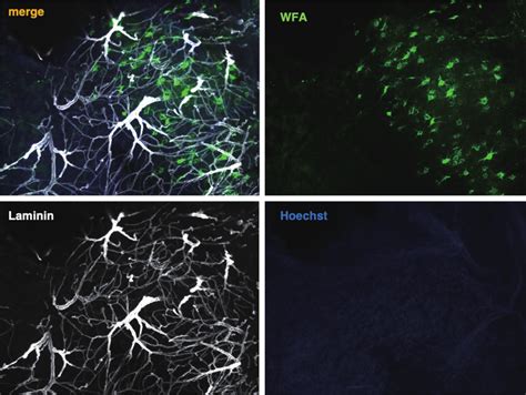 Confocal Image Of The Decellularized Brain Tissue Stained With Laminin