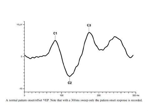 Visual Evoked Potentials Pptx