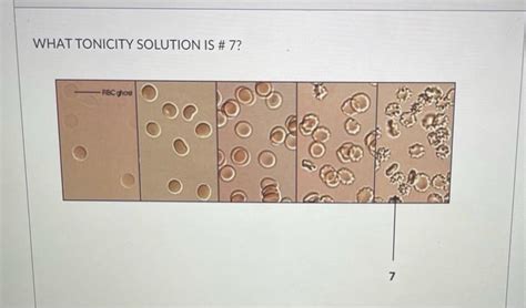 Solved What Tonicity Solution Is 7 Rbc Thou 7