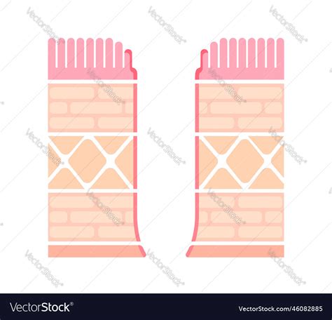 Sectional View Of Perforated Ulcer Royalty Free Vector Image
