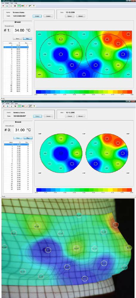 Different Resolutions Of The 3d Breast Model Download Scientific Diagram