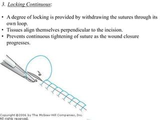Suture Pdf Suturing Techniques PPT