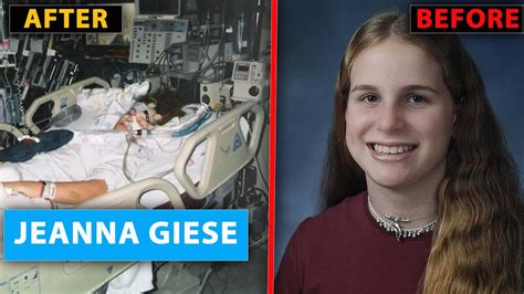 The Story Of The Woman Bitten By A Bat Jeanna Giese True Story