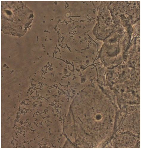 Vaginal Leptothrix An Innocent Bystander Pmc