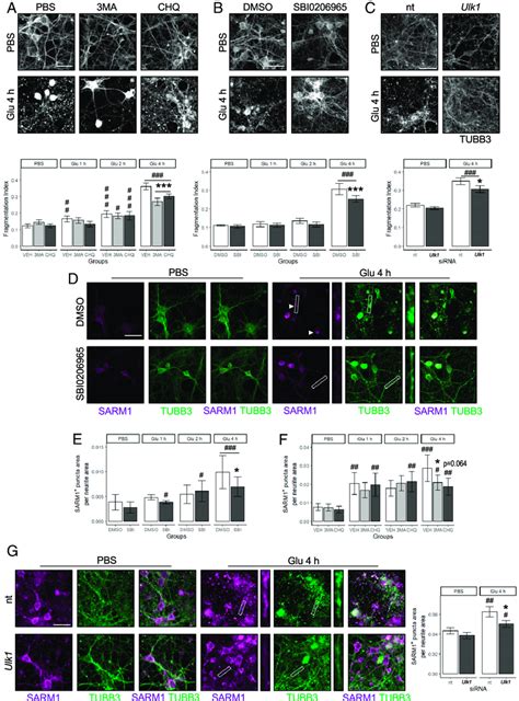 Inhibition Of Autophagy And Ulk1 Activity Attenuates Neurite