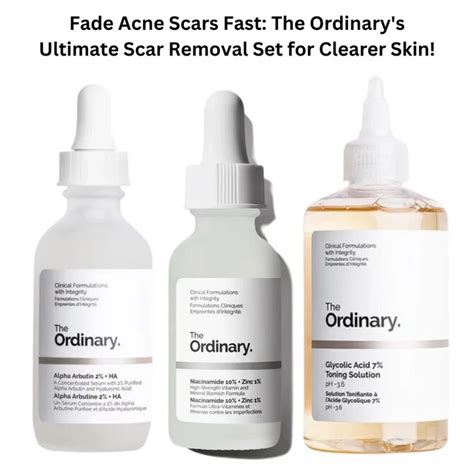 Fade Acne Scars Fast The Ordinarys Ultimate Scar Removal Set For Cle