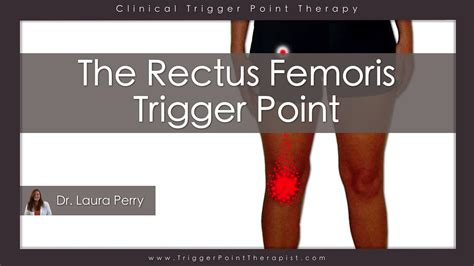 The Rectus Femoris Trigger Point YouTube