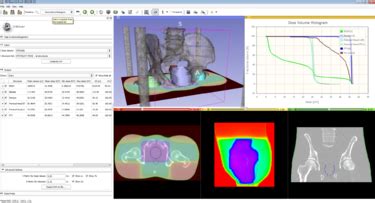 Documentation Announcements Slicer Wiki