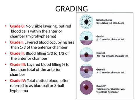 Hypopyon Vs Hyphemapptx