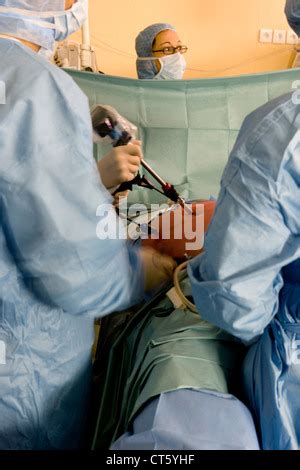 COLON RESECTION LAPAROSCOPY Stock Photo Alamy