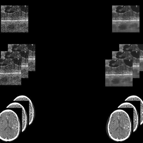 we propose three modi of our spatio temporal denoising algorithm in