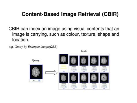 Ppt Content Based Retrieval Of 3d Medical Images Powerpoint