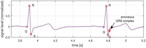 Github Dhirajhrecg Based Biometric Authentication Algorithm