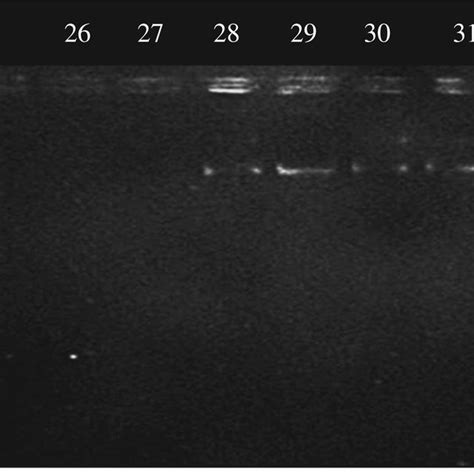 Gel Picture Of Genomic Dna Elution With Elution Buffer 4 Heated Up To