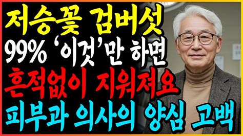 집에서 검버섯 없애는 방법 3가지 현직 피부과 의사가 밝힌 7일의 기적 따라만하면 검버섯 기미가 모두 사라집니다 검버섯 제거하는 효과적인 음식 ｜검버섯｜검버섯 제거방법
