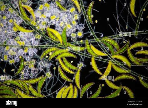 Darkfield And Polarised Light Micrograph Of Staurastrum Sp Spirogyra