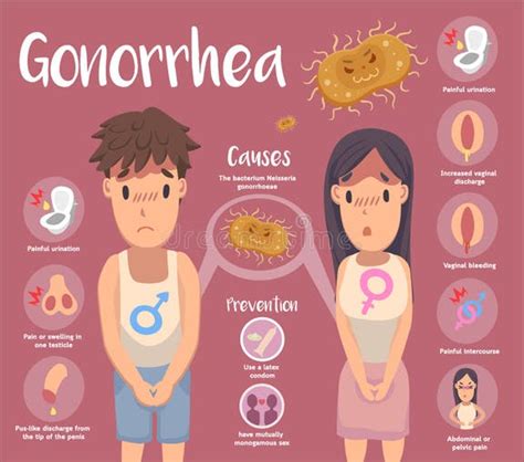 Infographic Of Gonorrhea Stock Vector Illustration Of Character